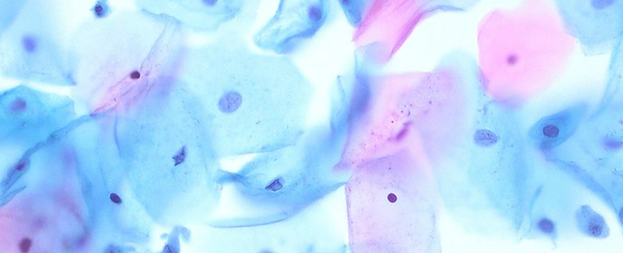 BIOGNOST RAPID PAP STAINING KIT SUPPORTS EARLY DIAGNOSIS OF CERVICAL ...